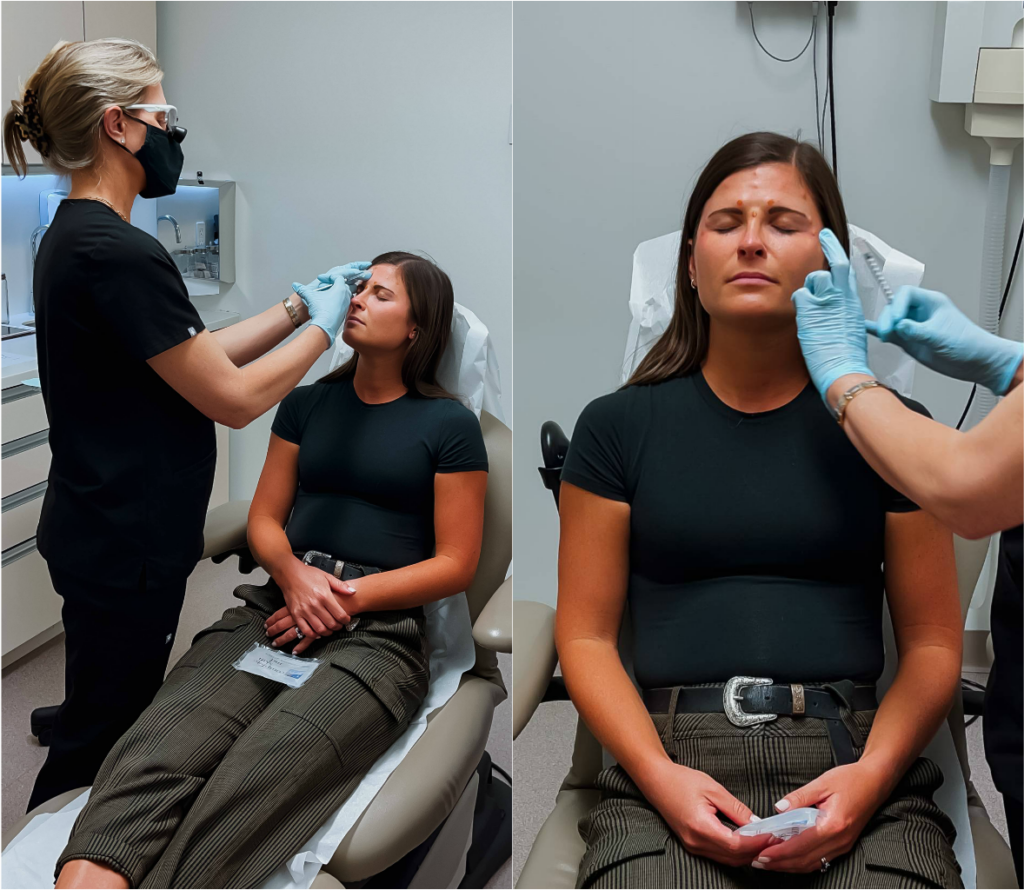 My First Botox Experience At 30